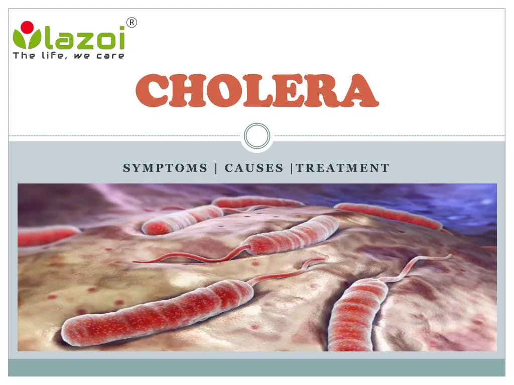 PPT - Cholera : Symptoms, causes and treatment PowerPoint Presentation ...