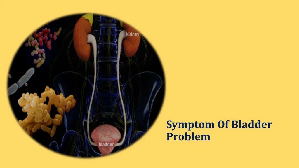 PPT - Symptom Of Bladder Problem PowerPoint Presentation, free download ...