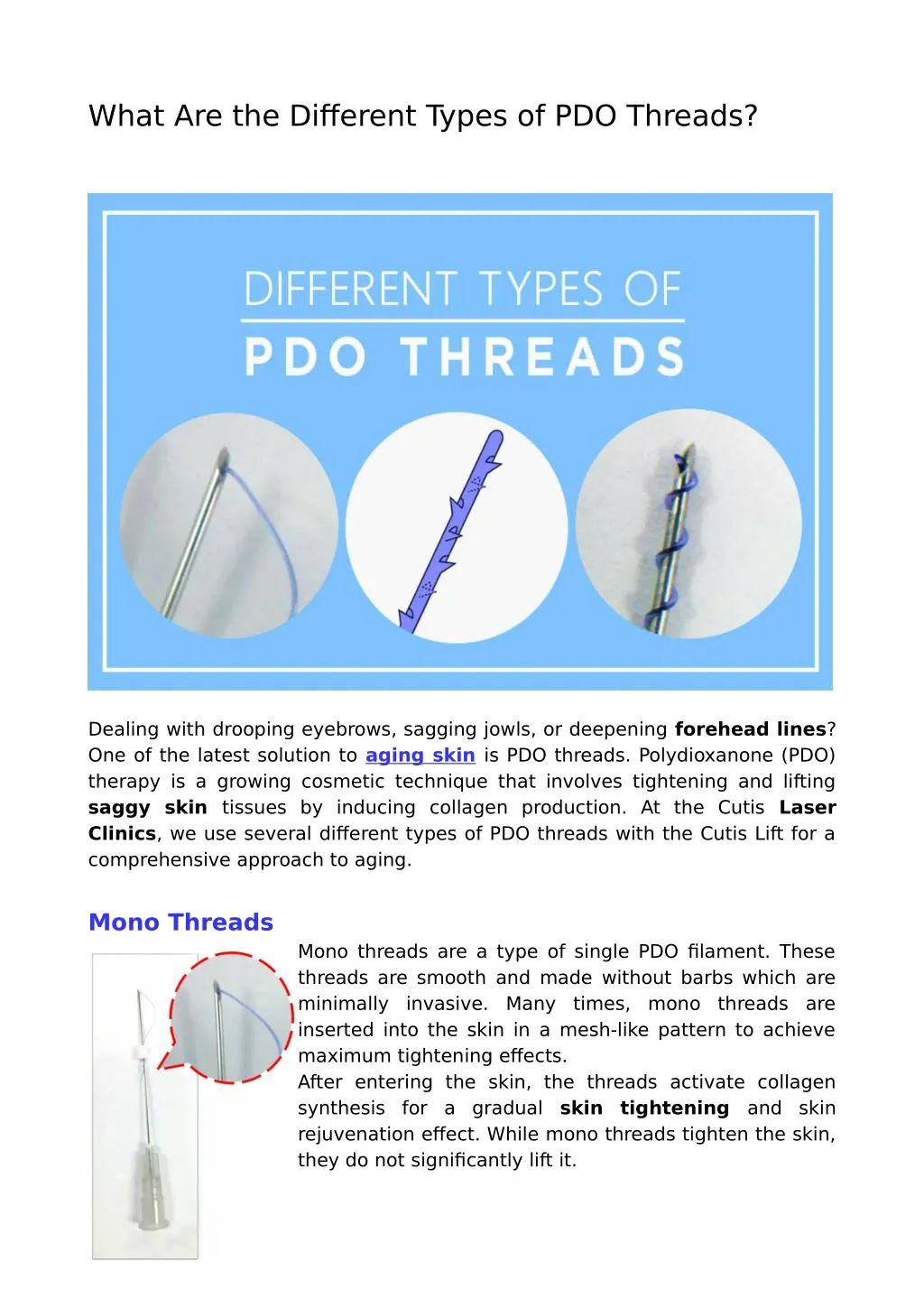 PPT - What Are the Different Types of PDO Threads? PowerPoint ...