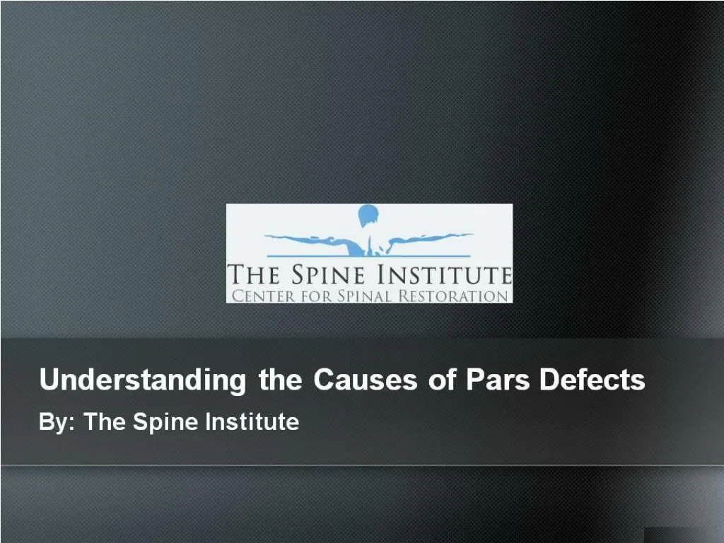 PPT - Understanding the Causes of Pars Defects PowerPoint Presentation ...