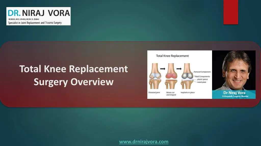 PPT - Total Knee Replacement Surgeon Mumbai | Knee Joint Resurfacing ...