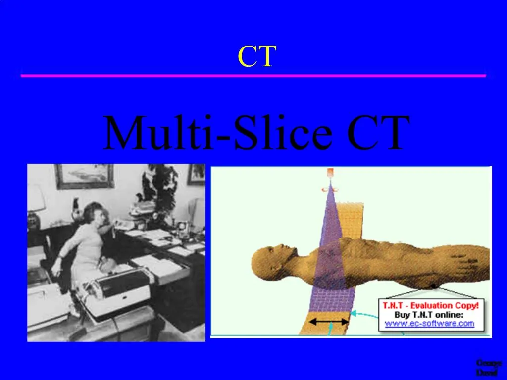 PPT - Multi-Slice CT PowerPoint Presentation, free download - ID:760864