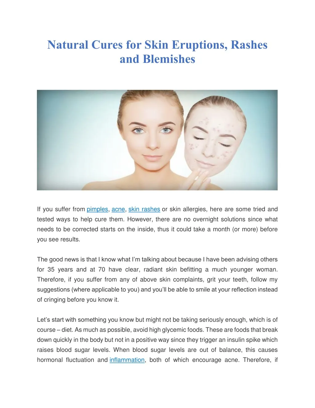 PPT - Natural Cures for Skin Eruptions, Rashes and Blemishes PowerPoint ...