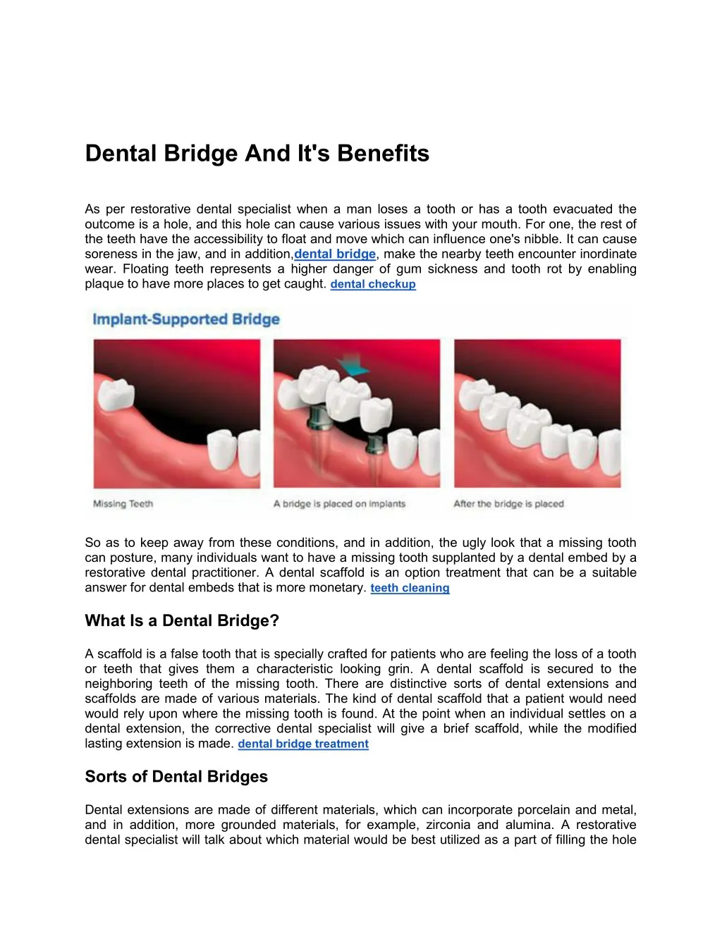 PPT - Dental Bridge And It's Benefits PowerPoint Presentation, free ...