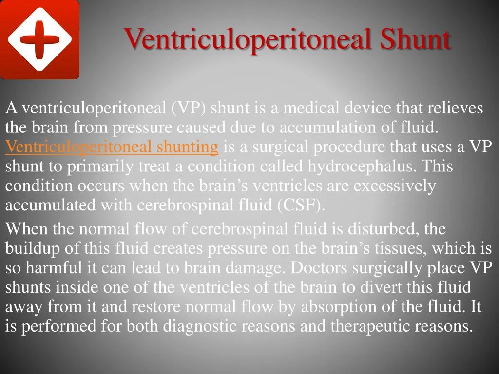 PPT - Ventriculoperitoneal Shunt PowerPoint Presentation - ID:7670910
