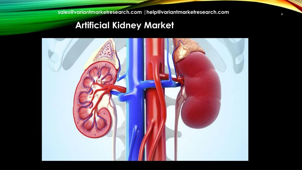 PPT - Artificial Kidney Market Global Scenario, Market Size, Outlook ...