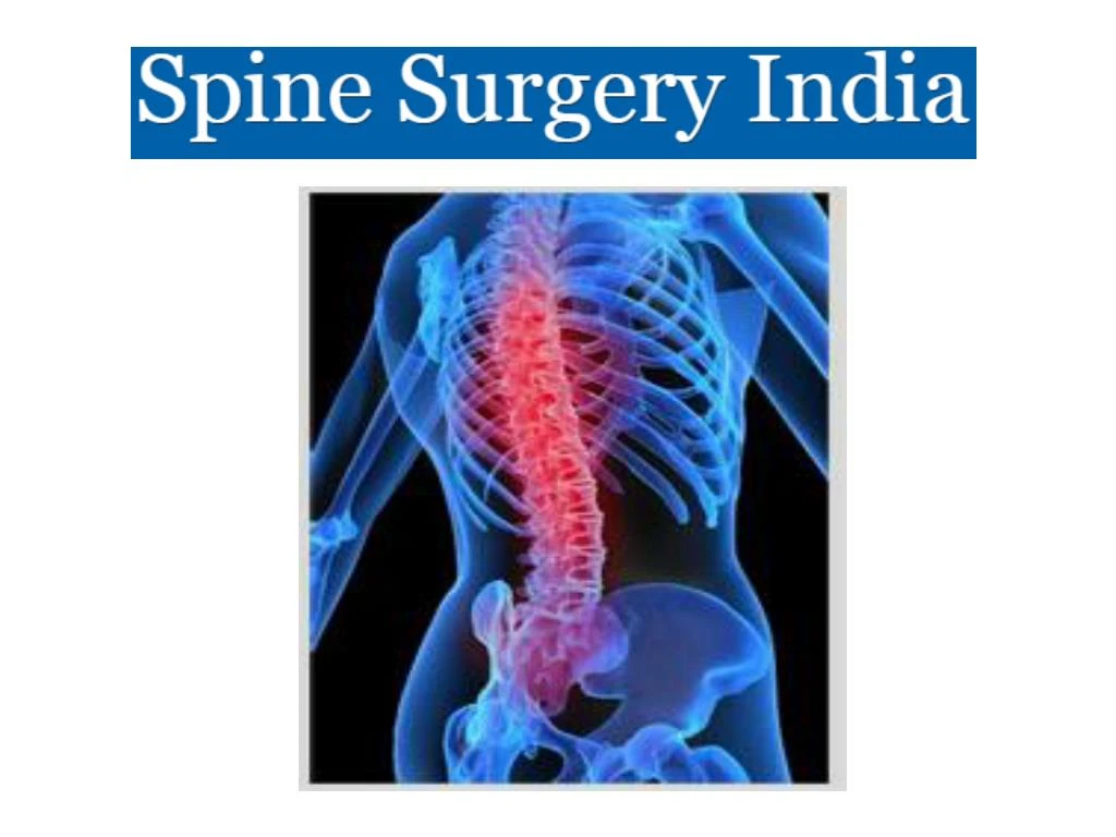 Ppt Minimally Invasive Laser Spine Surgery In India To Treat The 3943