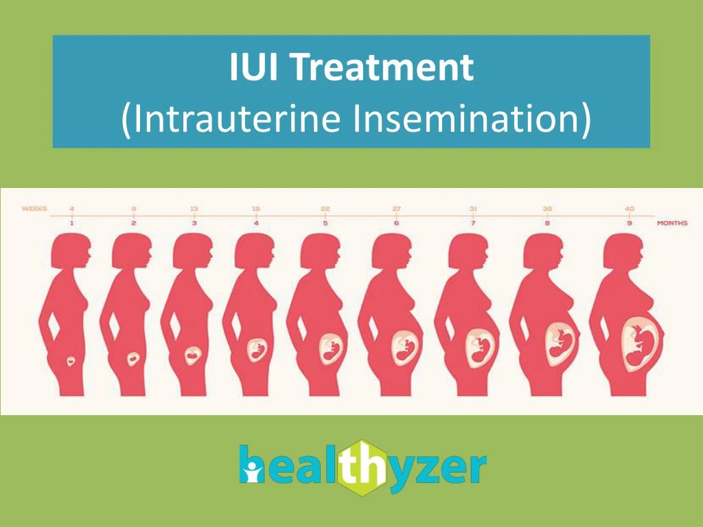 Ppt Intrauterine Insemination Iui Treament In Delhi India
