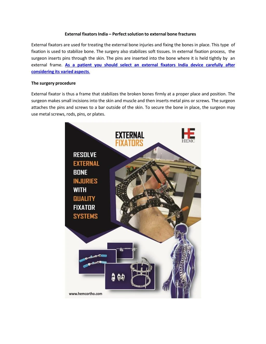 PPT - External fixators India â€“ Perfect solution to external bone ...