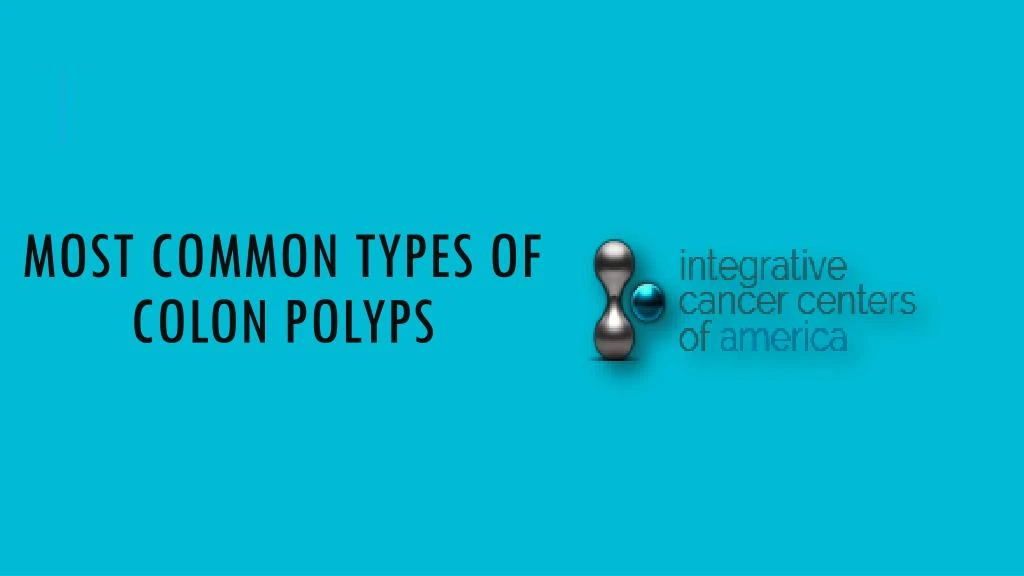 PPT - Most Common Types of Colon Polyps PowerPoint Presentation, free ...
