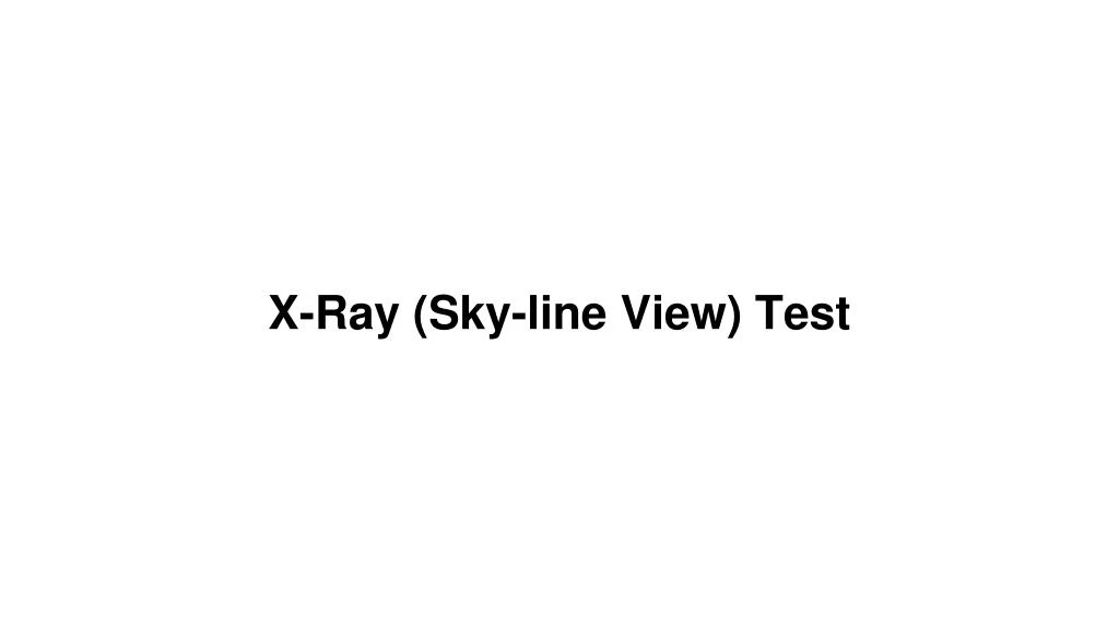 PPT - X ray (sky-line view) test PowerPoint Presentation, free download ...