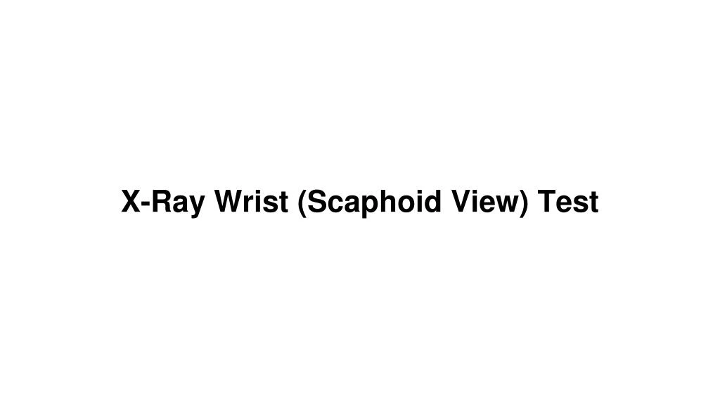 PPT - X ray wrist (scaphoid view) test PowerPoint Presentation, free ...