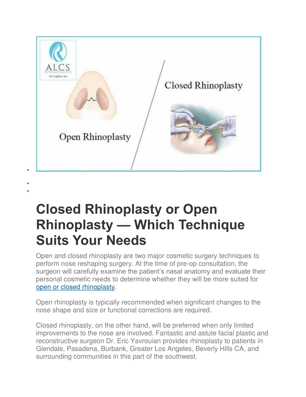 PPT - Closed Rhinoplasty or Open Rhinoplasty â€” Which Technique Suits ...