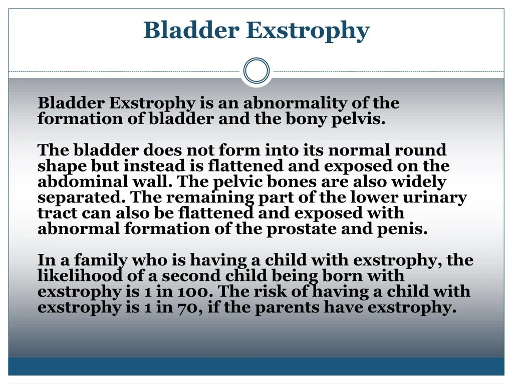 PPT - Bladder Exstrophy PowerPoint Presentation - ID:7932163