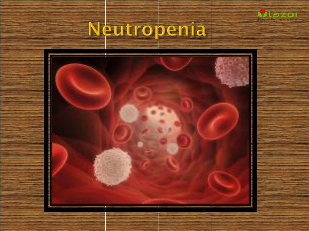 PPT - Neutropenia: Causes, Symptoms, Daignosis, Prevention and ...
