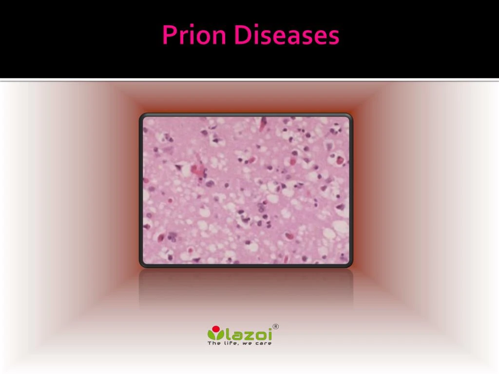 PPT - Prion Disease: Causes, Symptoms, Daignosis, Prevention and ...