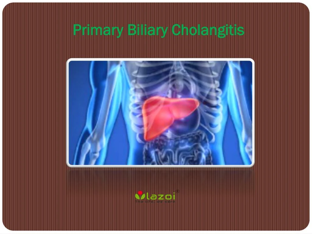 PPT - Primary Biliary Cholangitis: Causes, Symptoms, Daignosis ...