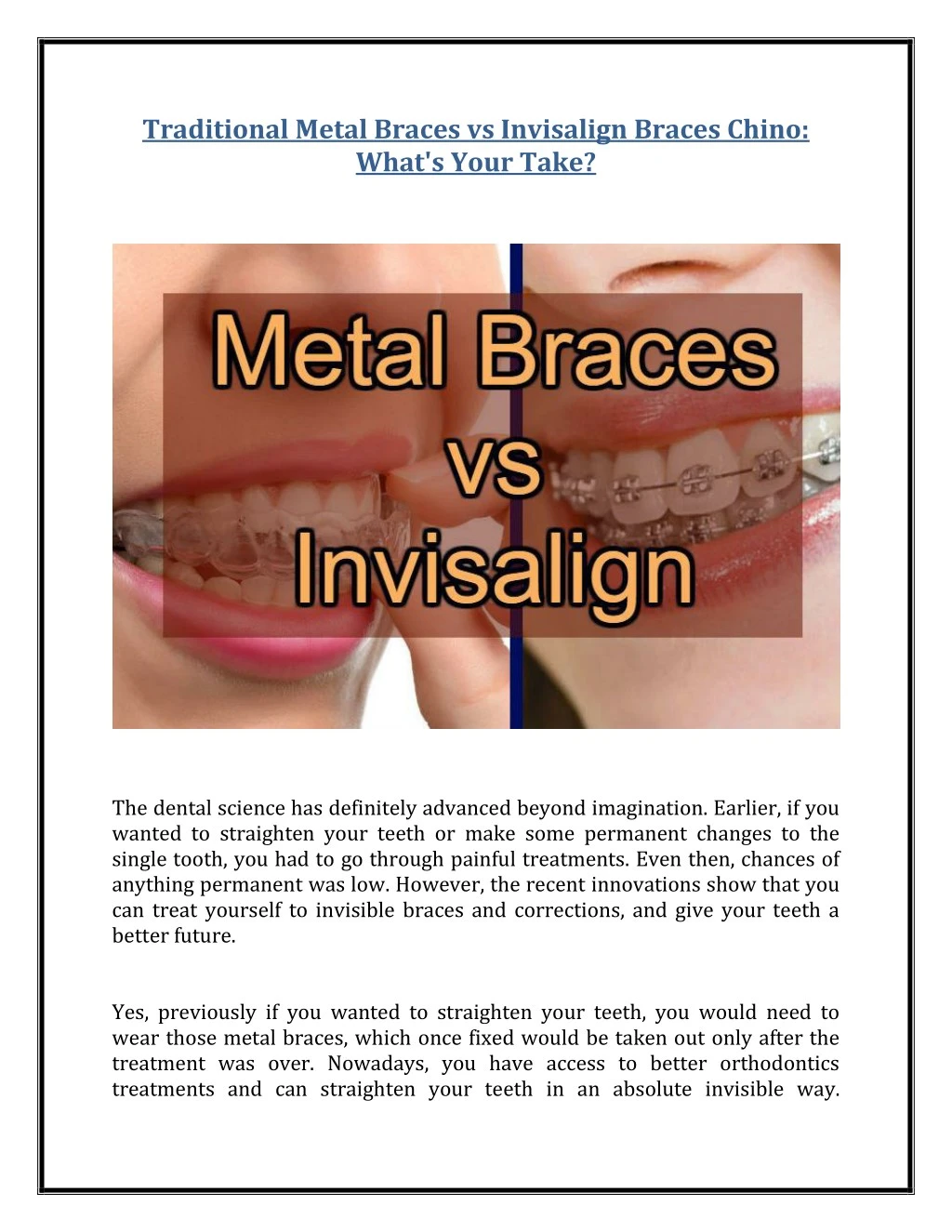 Ppt Traditional Metal Braces Vs Invisalign Braces Chino Whats Your