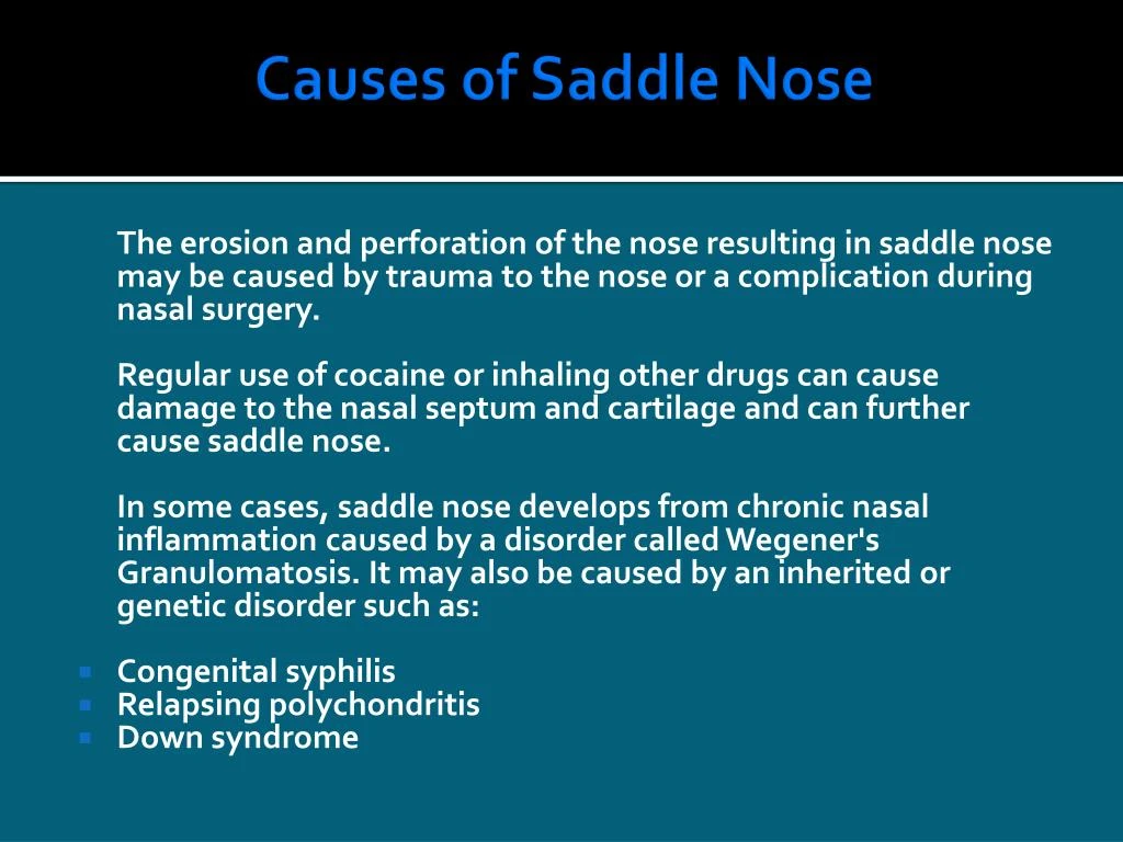 PPT - Saddle Nose PowerPoint Presentation - ID:8004623