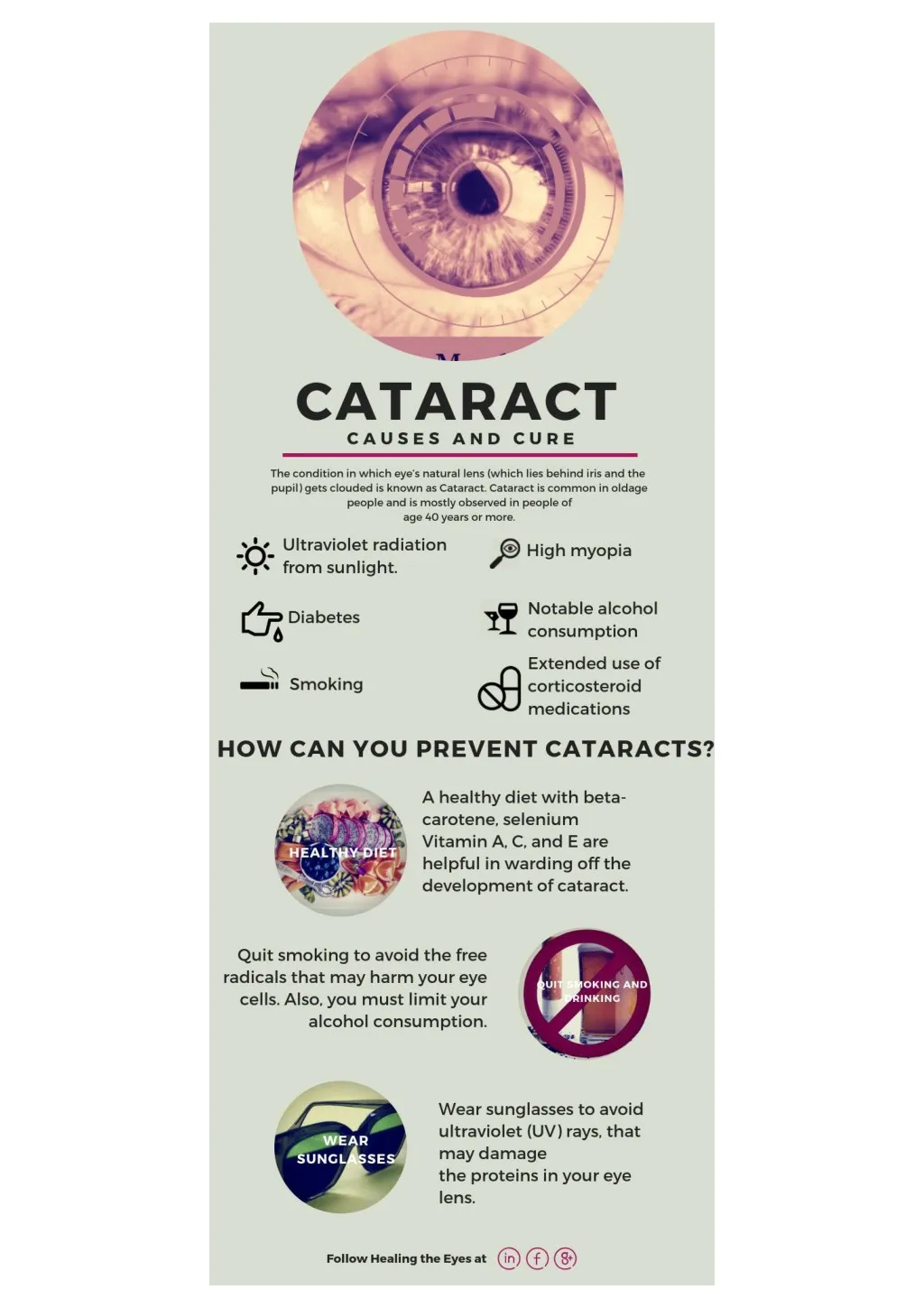 PPT - Cataract and Its Prevention PowerPoint Presentation, free ...