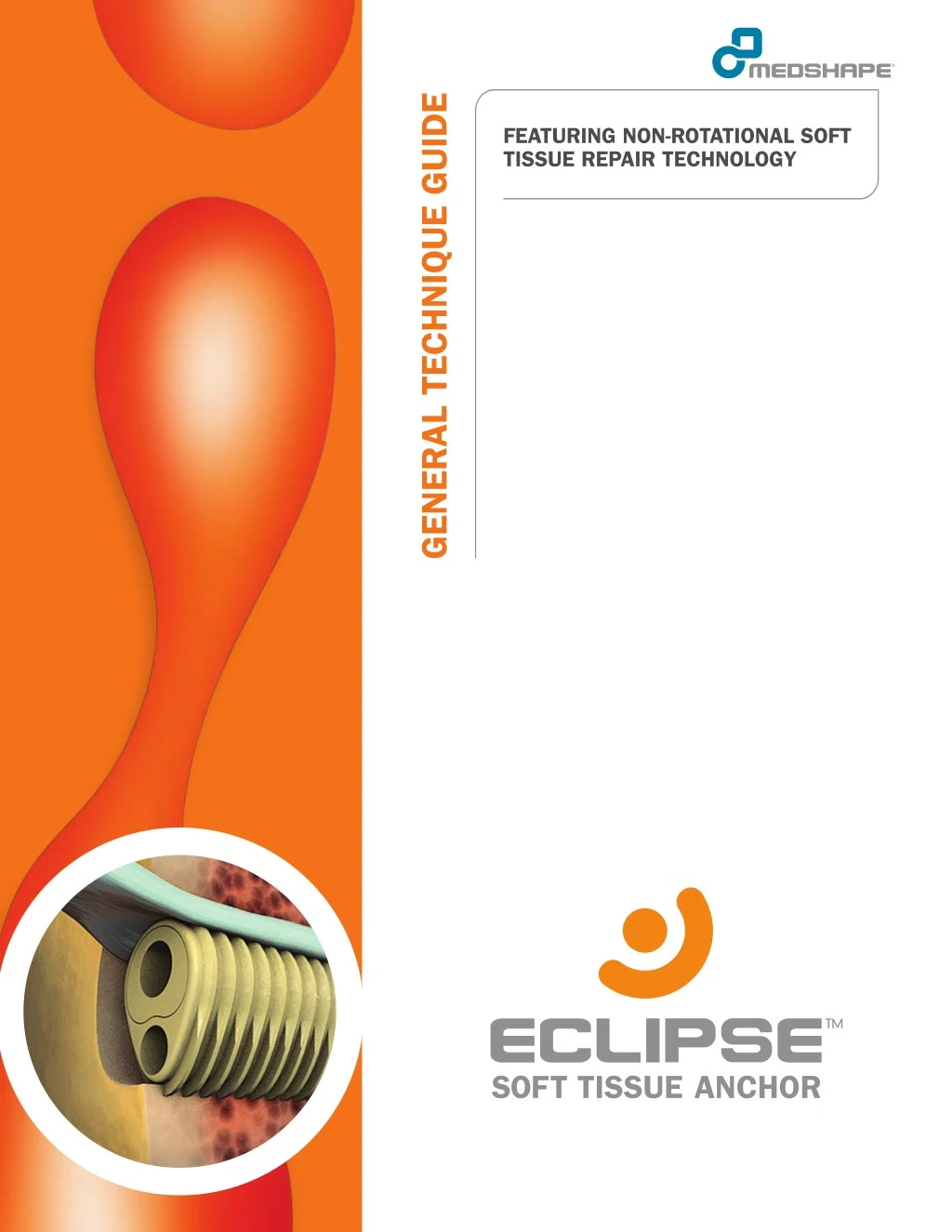 PPT - Eclipse™ Soft Tissue Anchor – General Technique Guide PowerPoint ...