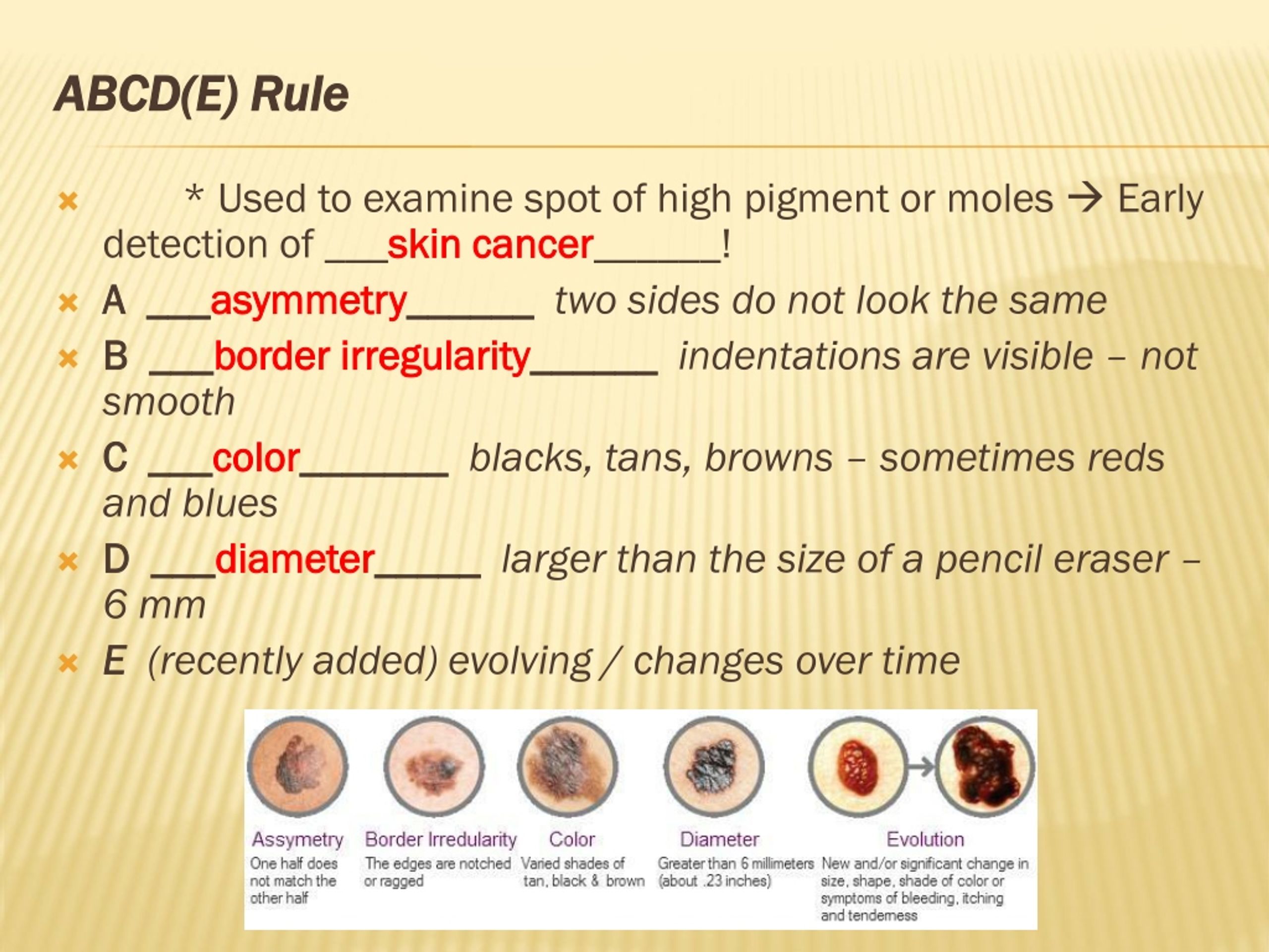 PPT - SKIN CANCER & BURNS PowerPoint Presentation, free download - ID ...