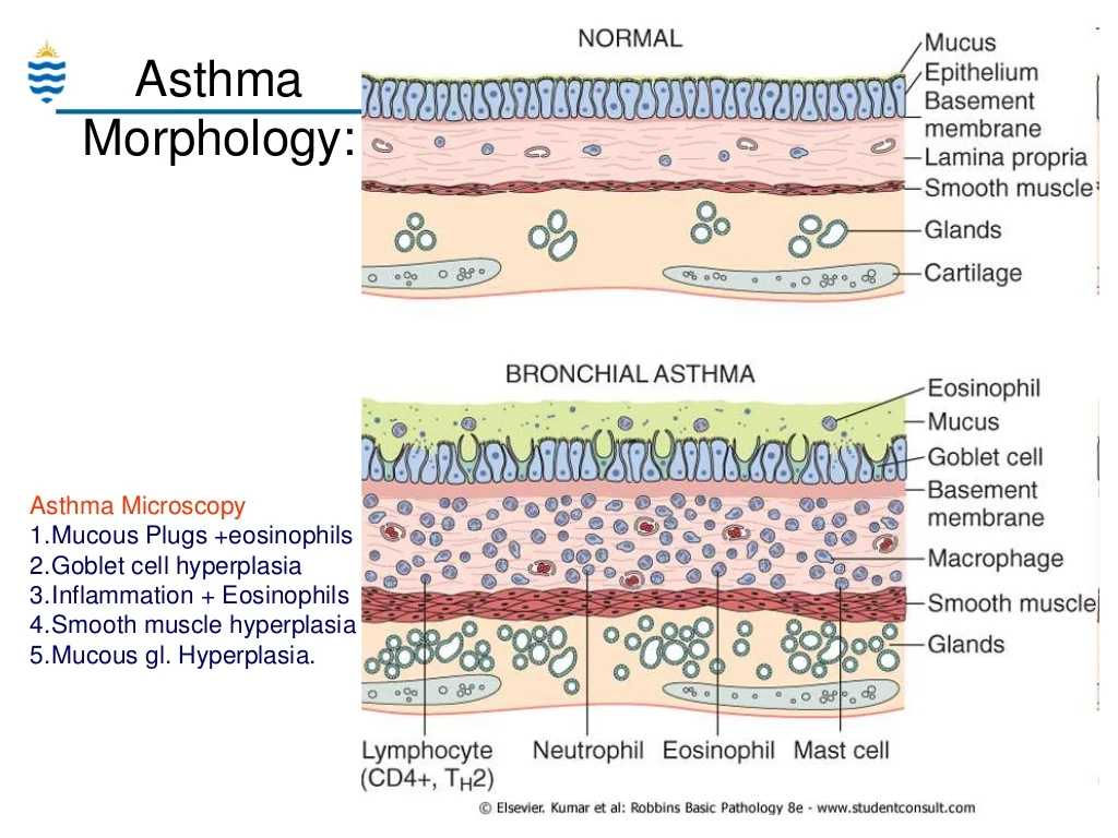 PPT - Pathology Review-Term1 PowerPoint Presentation - ID:8201933
