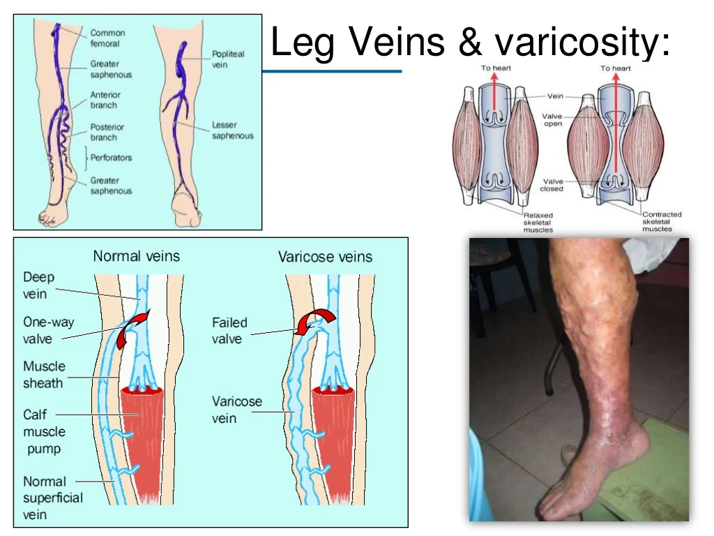 PPT - Pathology Review-Term1 PowerPoint Presentation - ID:8201933