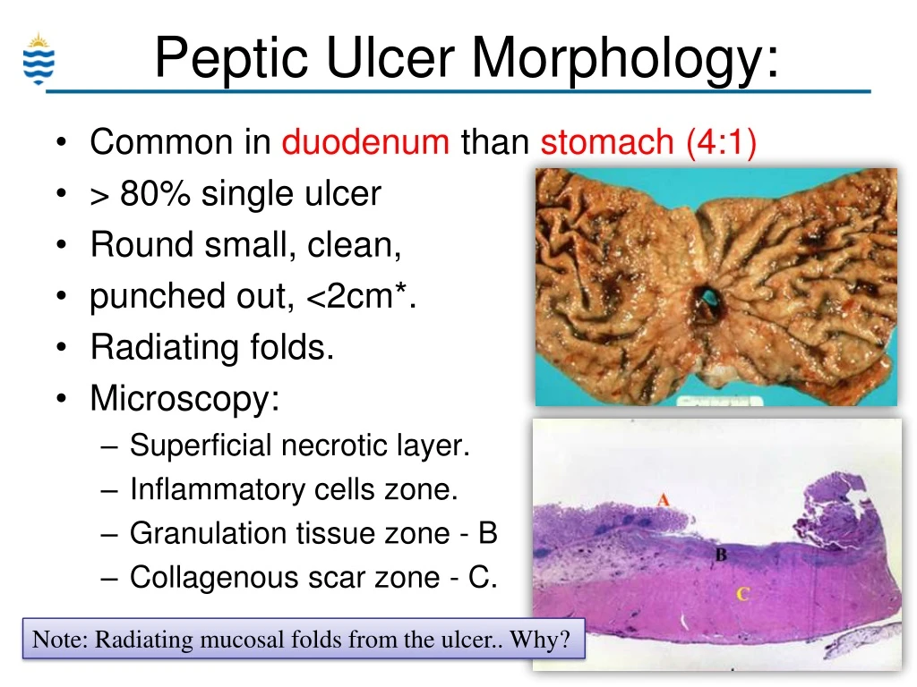 PPT - Pathology Review-Term2 PowerPoint Presentation - ID:8201938