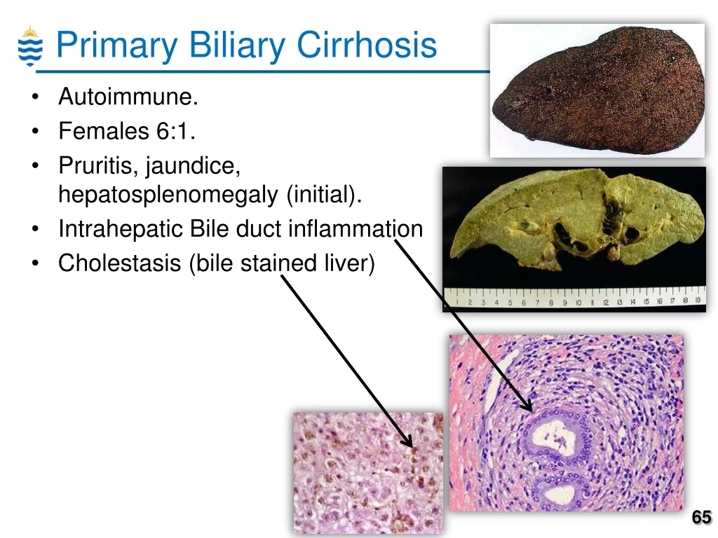 PPT - Pathology Review-Term2 PowerPoint Presentation - ID:8201938