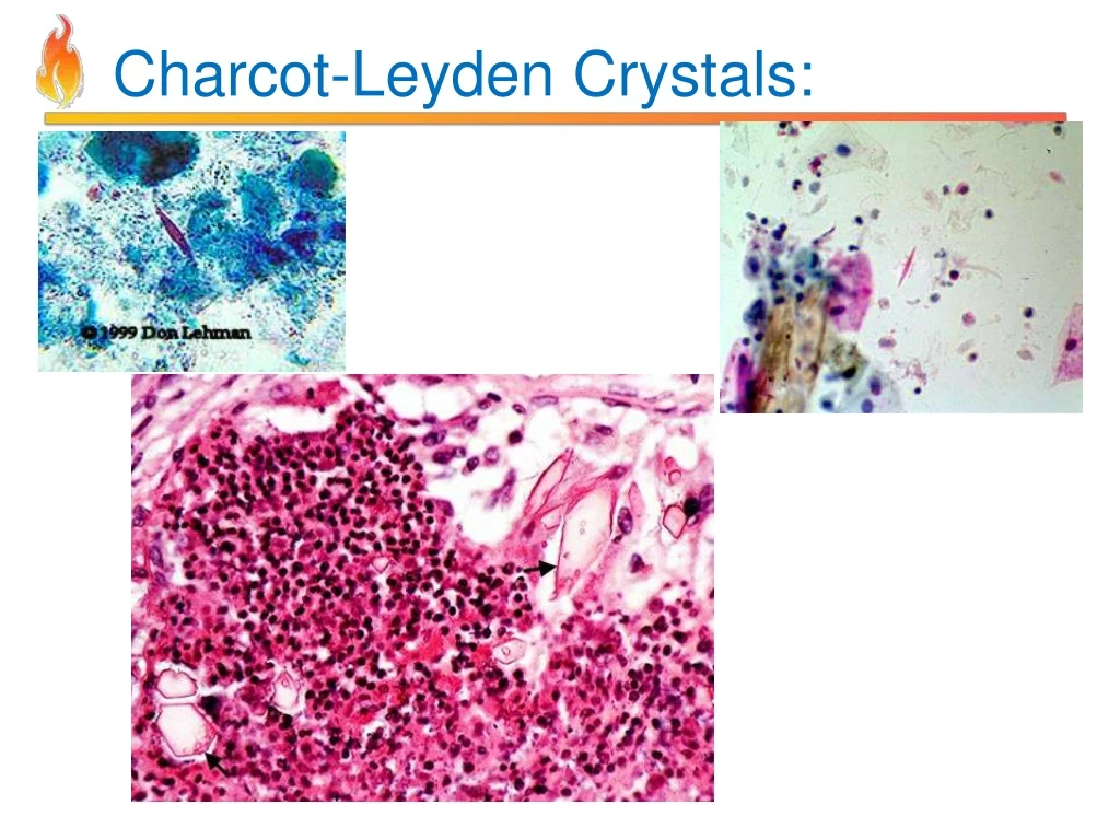 PPT - Pathology of COPD PowerPoint Presentation - ID:8201945