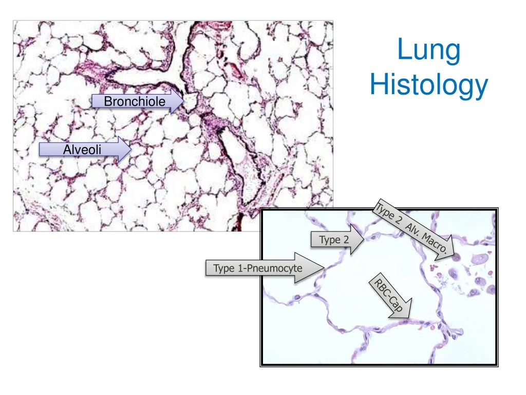 PPT - Pathology of COPD PowerPoint Presentation - ID:8201945