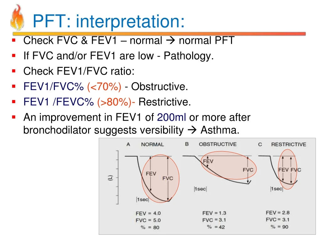 PPT - Pathology of COPD PowerPoint Presentation - ID:8201945