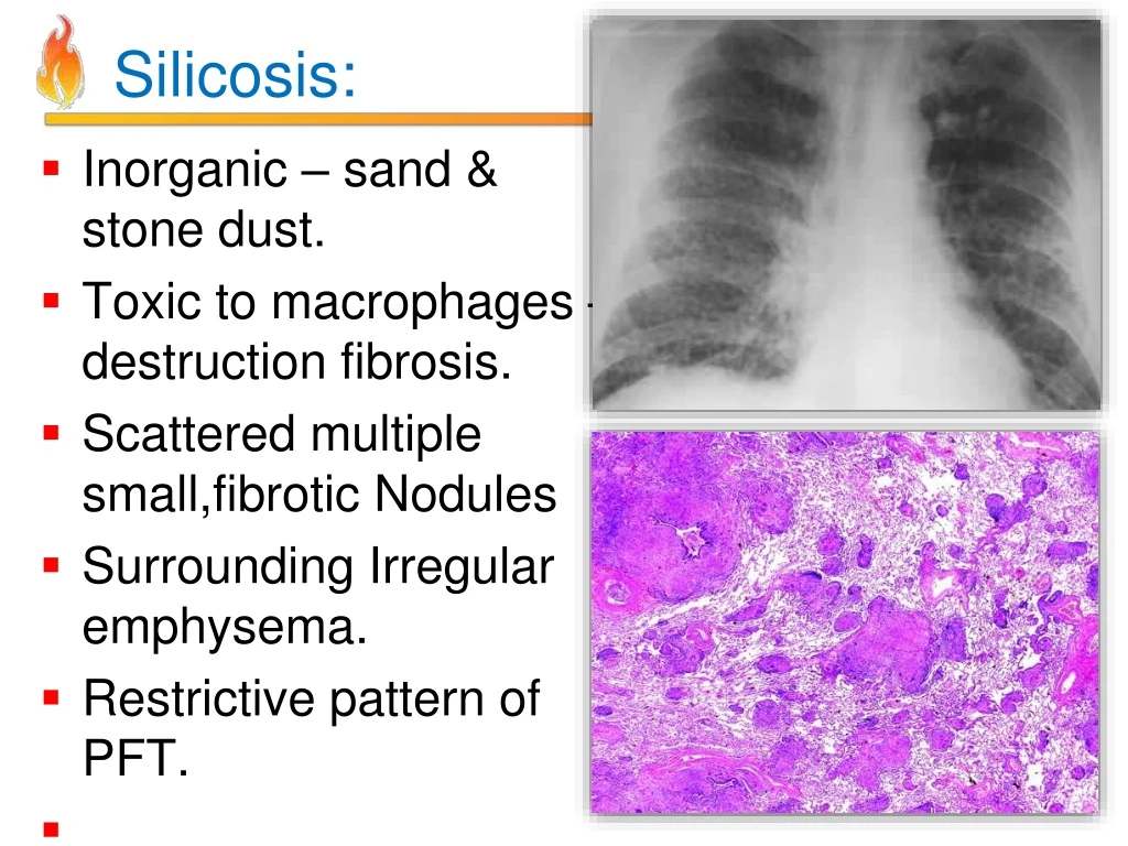 PPT - Pathology of COPD PowerPoint Presentation - ID:8201945