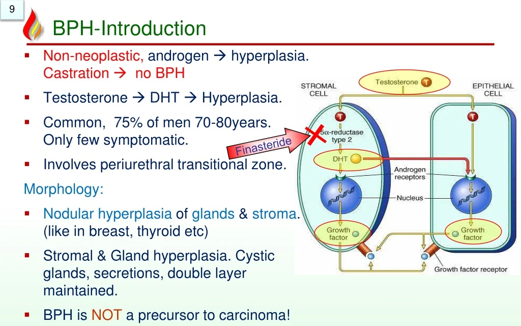 PPT - Pathology of Prostate - Benign PowerPoint Presentation - ID:8201954