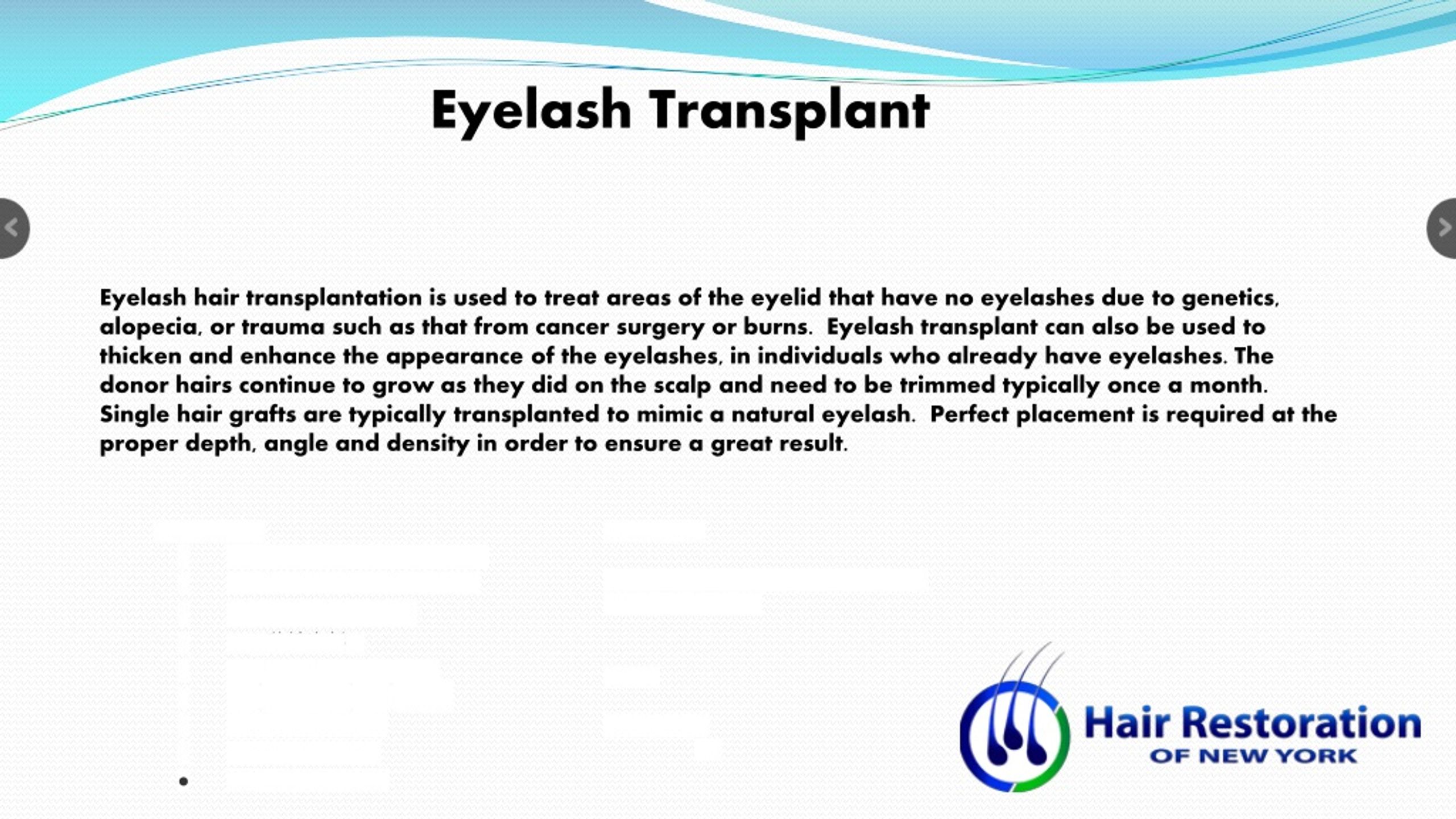 PPT - Best Hair Restoration NYC PowerPoint Presentation, free download ...