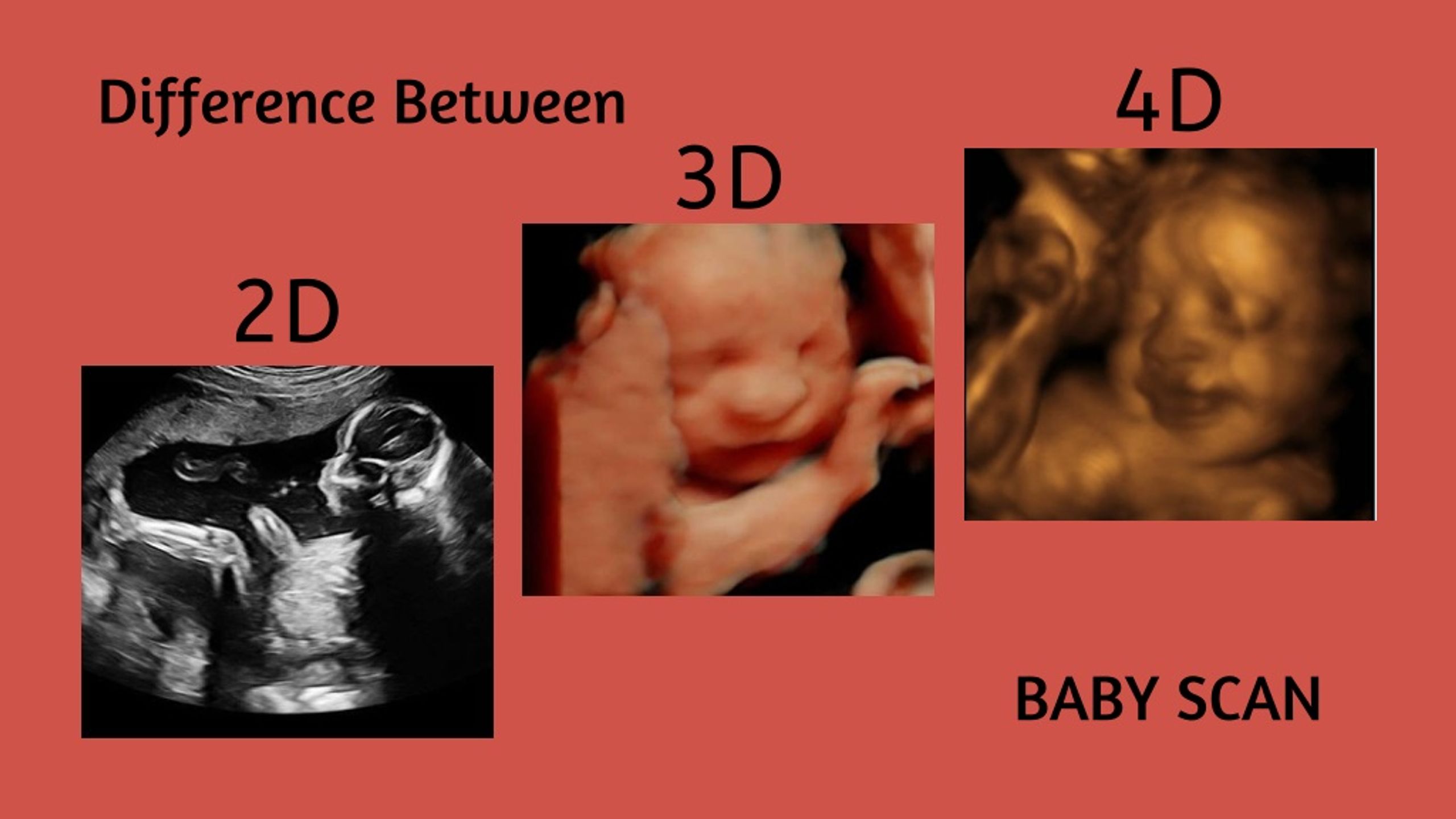 PPT Difference Between 2D 3D And 4D Ultrasound Baby Scan PowerPoint