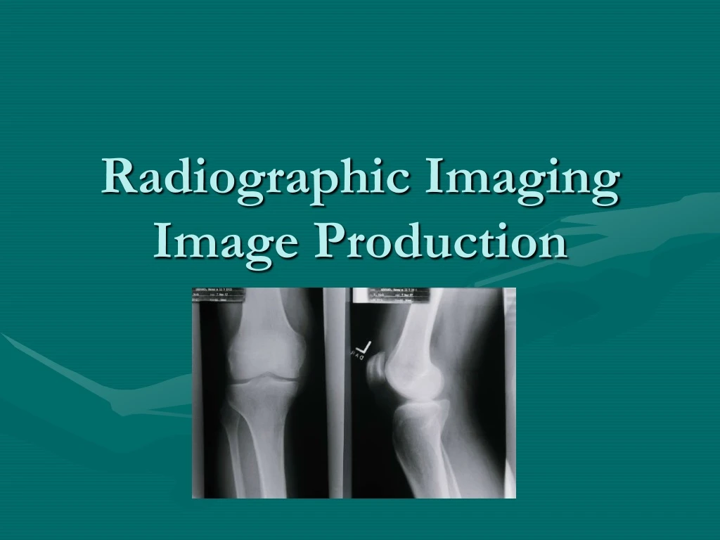 PPT - Radiographic Imaging Image Production PowerPoint Presentation ...
