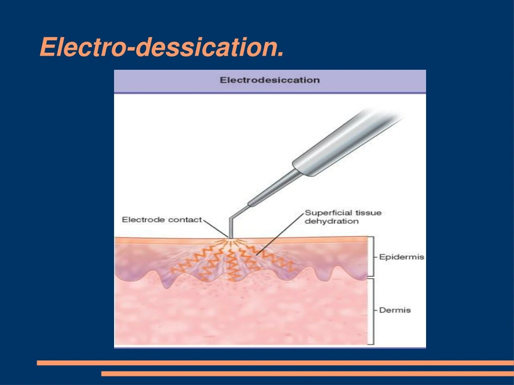 PPT - Electro-dessication. PowerPoint Presentation, free download - ID ...