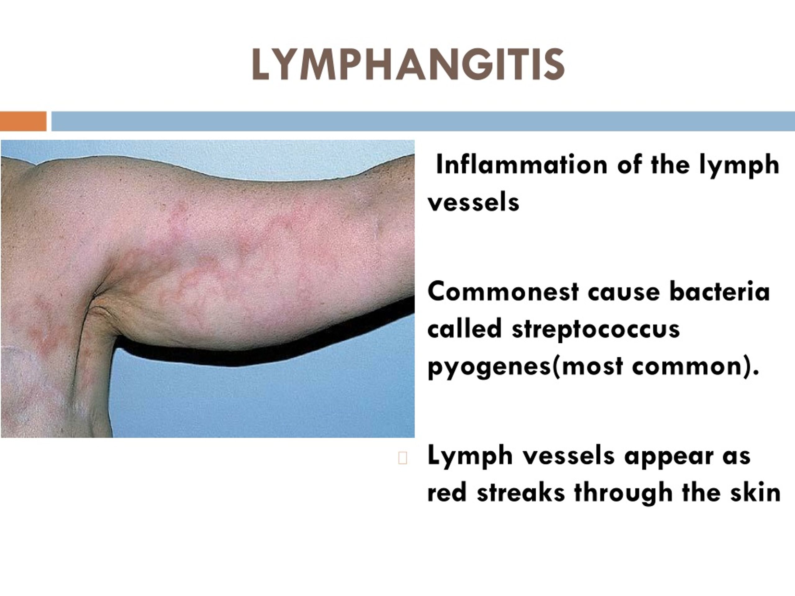 PPT LYMPHATIC SYSTEM PowerPoint Presentation Free Download ID 8733787 PPT LYMPHATIC SYSTEM PowerPoint Presentation Free Download ID 8733787