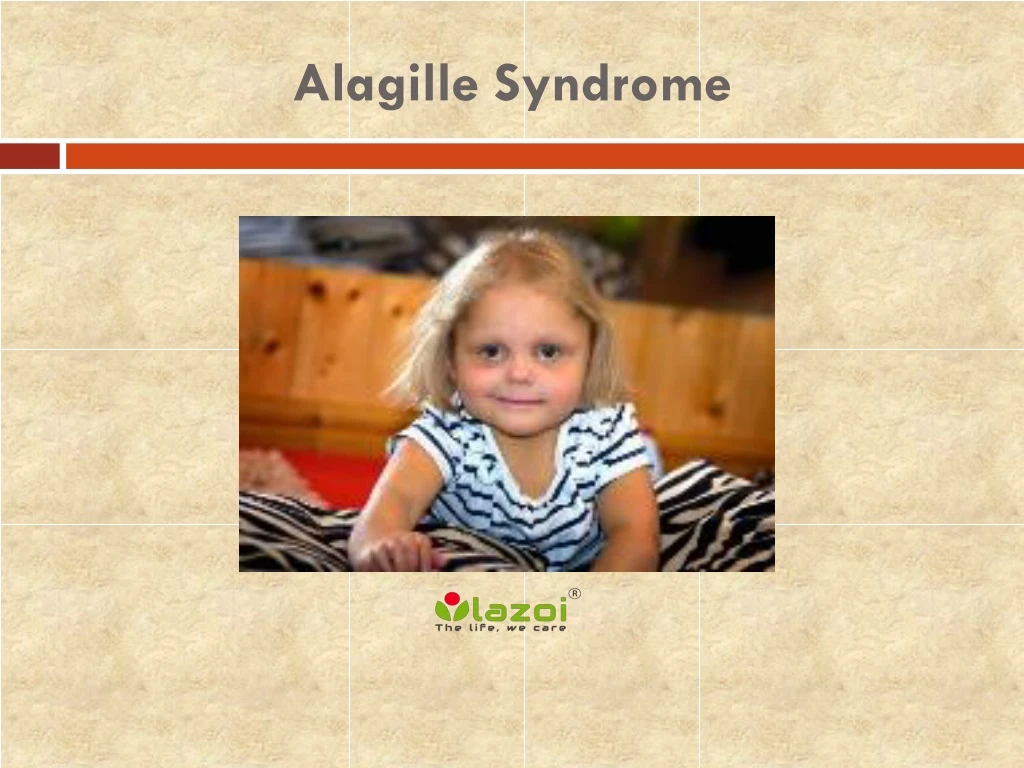 PPT - Alagille Syndrome PowerPoint Presentation, free download - ID:8782600