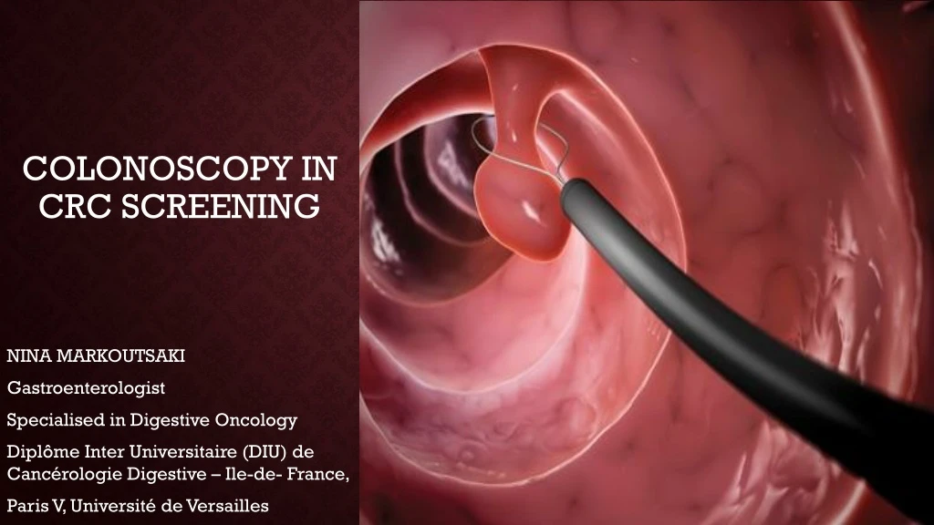 PPT - Colonoscopy in crc screening PowerPoint Presentation, free ...