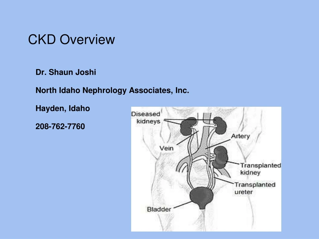 PPT - CKD Overview PowerPoint Presentation, free download - ID:8788259