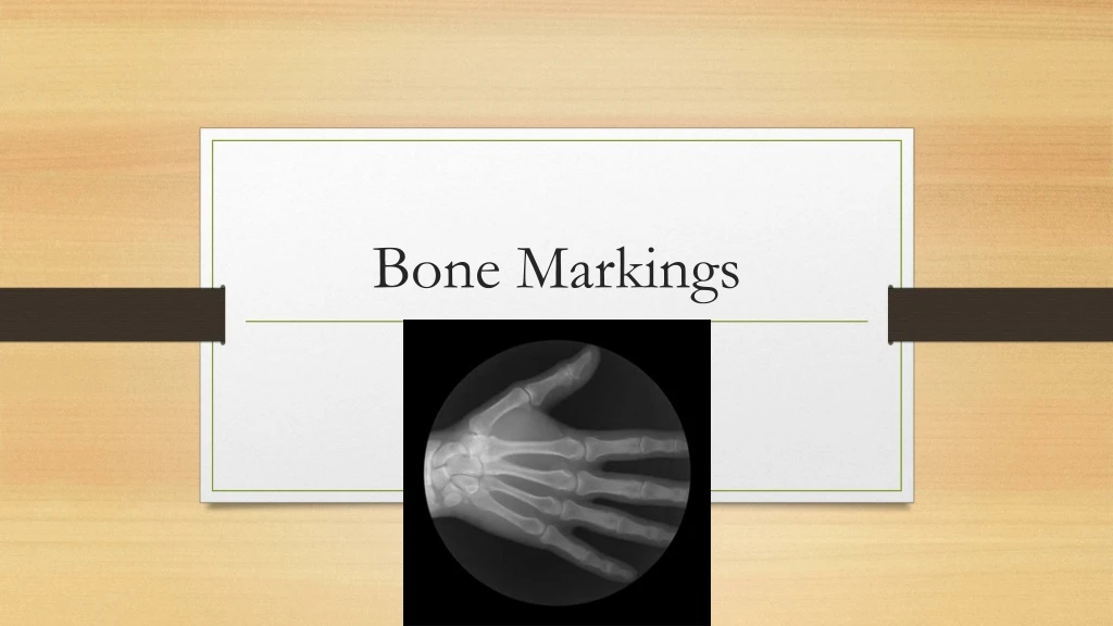 PPT - Bone Markings PowerPoint Presentation, free download - ID:8821442