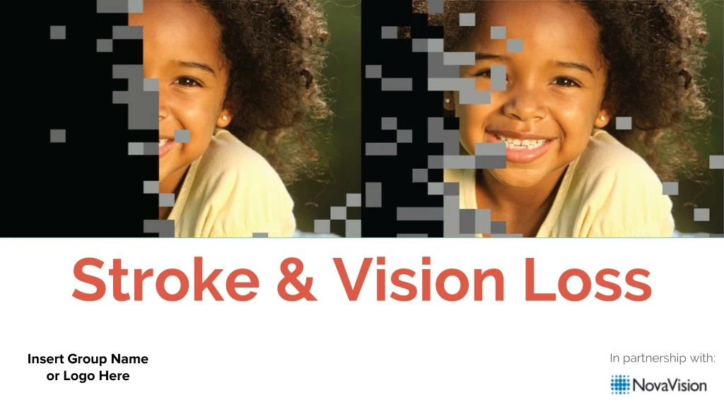 PPT - Stroke & Vision Loss PowerPoint Presentation, free download - ID ...
