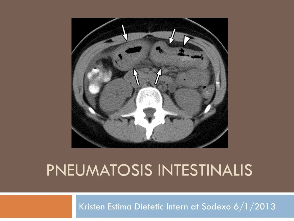 PPT - Pneumatosis intestinalis PowerPoint Presentation, free download ...