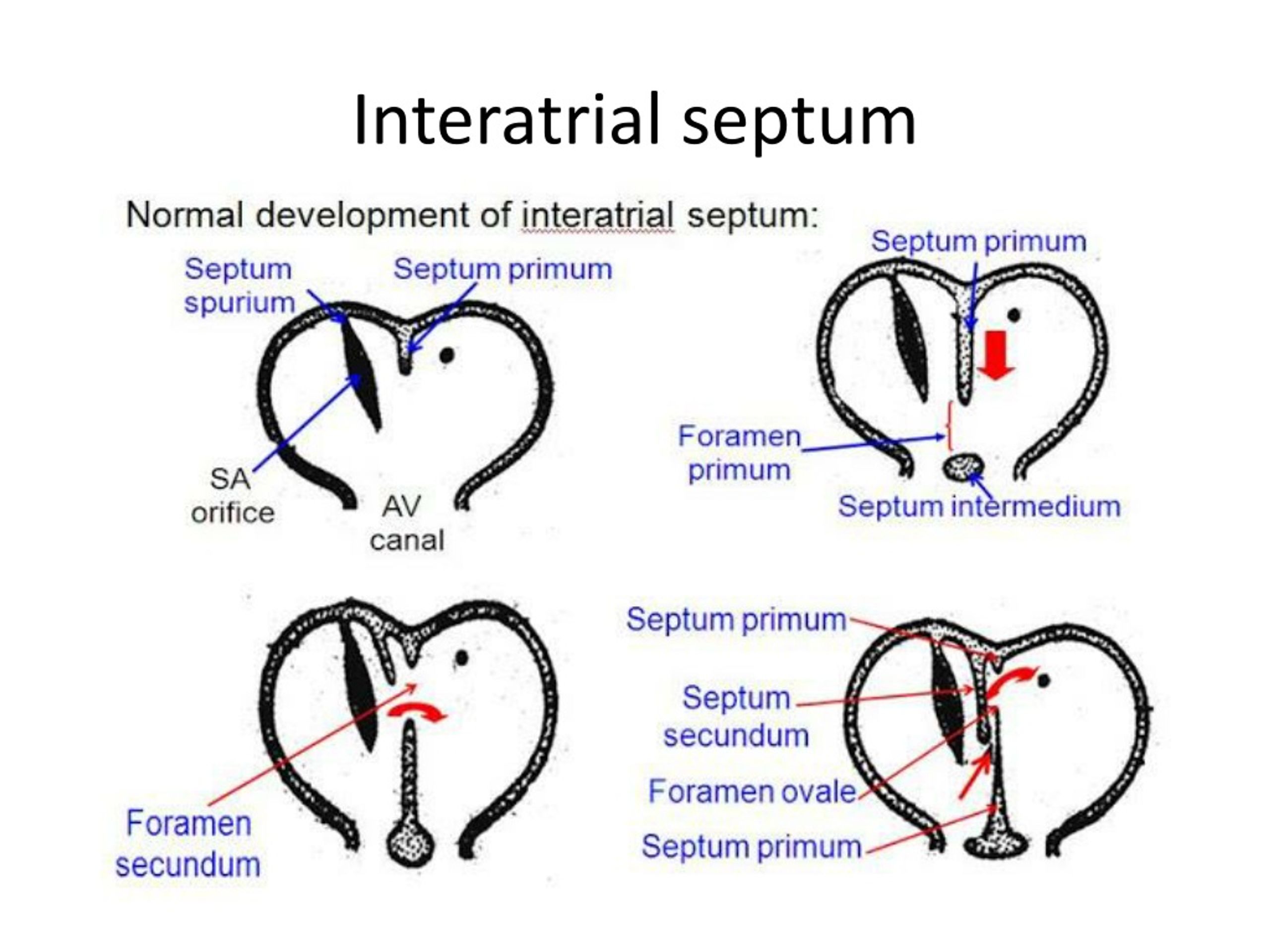 PPT Understanding Heart Development Key Structures Defects And PPT Understanding Heart Development Key Structures Defects And