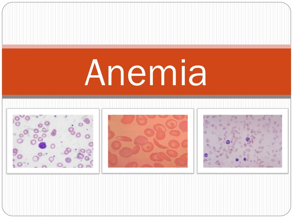PPT - Anemia PowerPoint Presentation, free download - ID:8865766