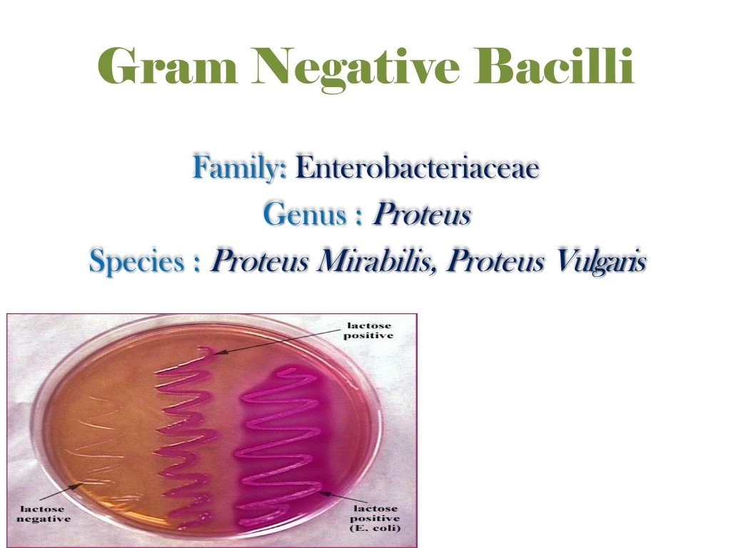 PPT - Gram Negative Bacilli PowerPoint Presentation, free download - ID ...
