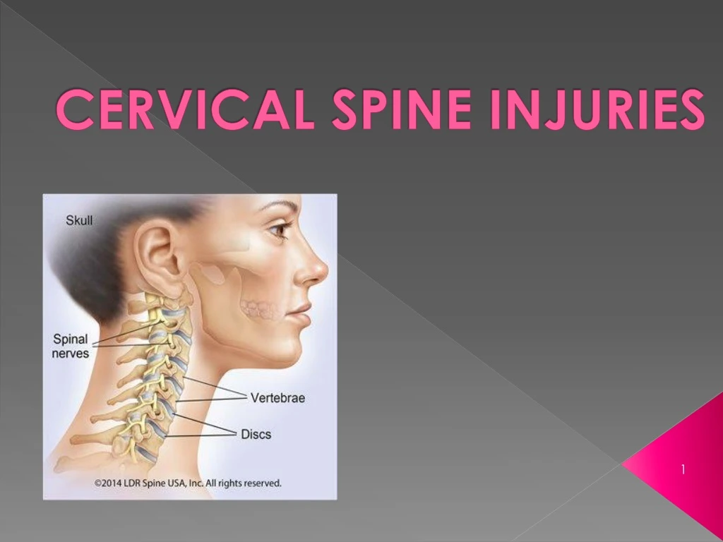 PPT - CERVICAL SPINE INJURIES PowerPoint Presentation, free download ...